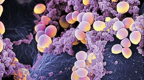 Primele semne ale infecției cu STAFILOCOC AURIU!